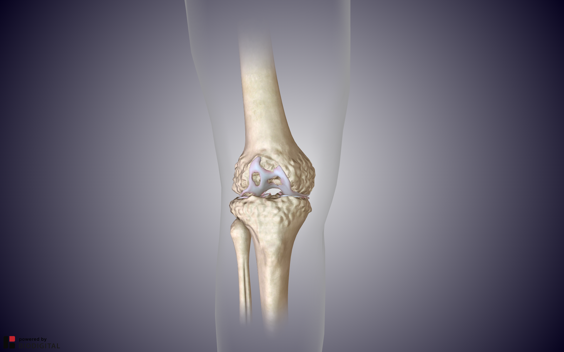 Artritis postraumática en la rodilla - Instituto Universitario Vive Sano